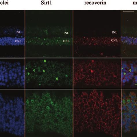 Nucleocytoplasmic Distribution Of Sirt1 In The Onl Of Rd10 Mouse Retina Download Scientific
