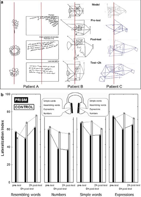 4 Cognitive Effects Of Prism Adaptation Top Daisy Drawing Dictation Download Scientific