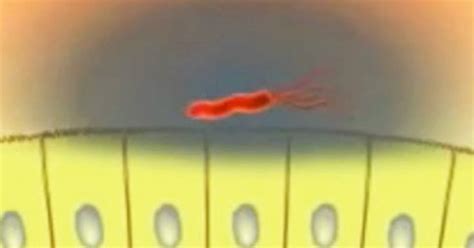 위암 재발도 헬리코박터가 원인