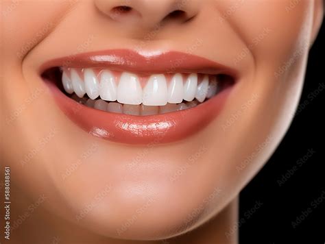 Sorriso Deslumbrante E Saúde Bucal Impecável Dentes Perfeitos Com