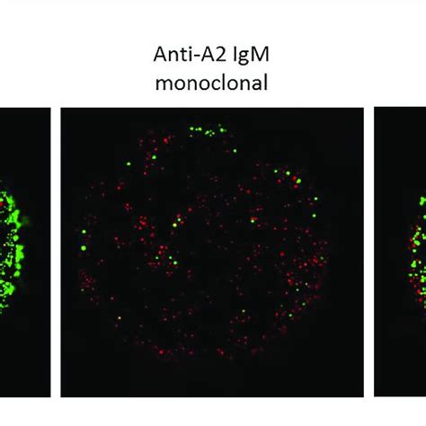 Complement Dependent Endothelial Cytotoxicity Using Machine