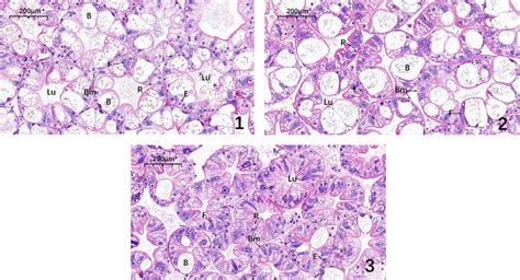 Hepatopancreas Tissue Structure Of C Destructor Grown At Different Download Scientific Diagram