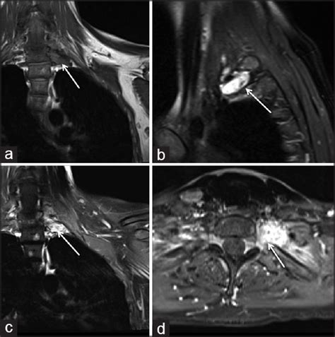 Surgical Neurology International