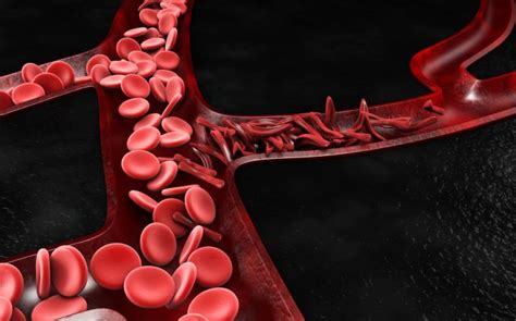 Eritrocite Scazute DivaHair Ro