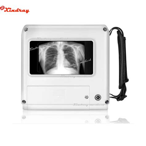 Hospital X Ray Machine Portable Handheld X Ray Camera For Chest Radiography Portable X Ray