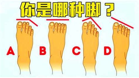 依据脚趾长度可分辨埃及脚罗马脚和希腊脚知道你是哪种吗 腾讯视频