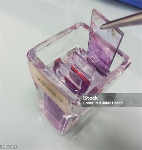 실험실에서 세포학 연구를위한 현미경 슬라이드 염색 조직 샘플의 암 진단 염색 시약이 든 코플린 염색 항아리 사람유두종바이러스에 대한 스톡 사진 및 기타 이미지 Istock