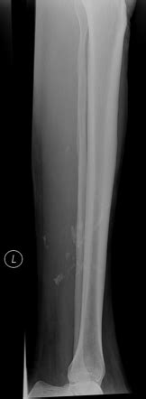 Image Radiopaedia Org