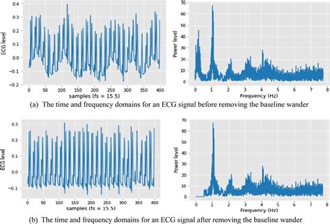 An Ecg Signal In Time And Frequency Domains Before And After Filtering Download Scientific Diagram