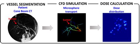 Radioembolization Cherry Lab
