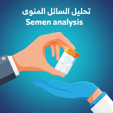 تحليل السائل المنوي مختبرات أنيس الخير