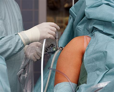 Shoulder Arthroscopy Vs Open Surgery By Comparison Piedmont