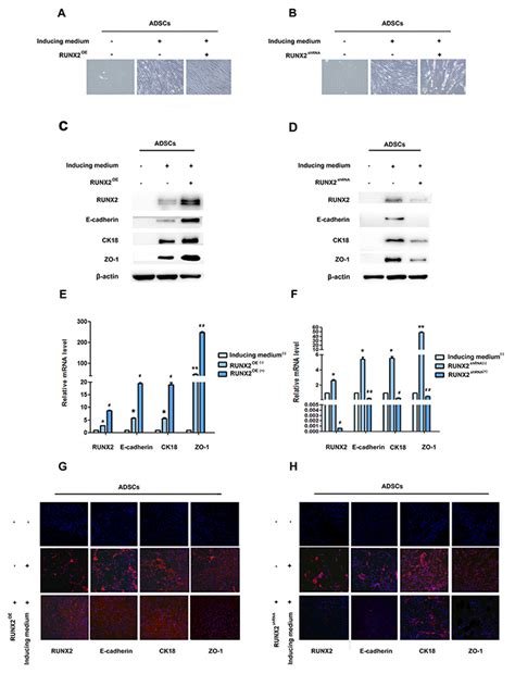 Runx2 Promotes Epithelial Differentiation Of Adscs And Burn Wound