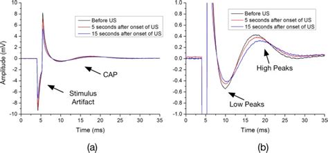 Vagus Nerve Compound Action Potentials Recorded Before And 5 And 15 S Download Scientific