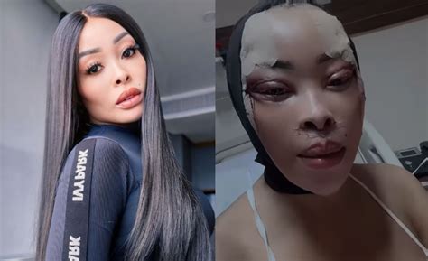 She Looks Scary” Khanyi Mbaus New Teeth Spark Mixed Reactions Watch