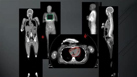 Forensic Imaging Fundamentals Introduction To Forensic Imaging Modalities Forensic Radiology
