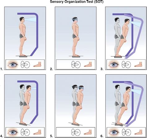 Six Conditions Of The Sensory Organization Test On The Neurocom Balance Download Scientific