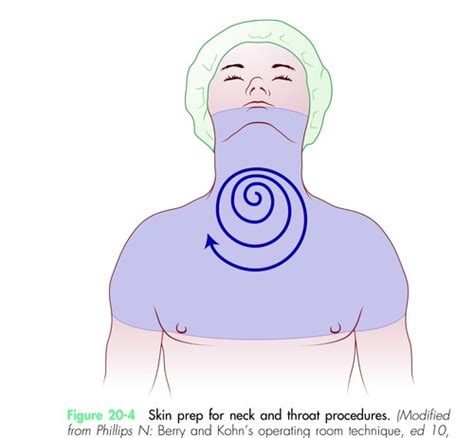 Cst Chapter 19 Surgical Skin Prep And Draping Flashcards Quizlet