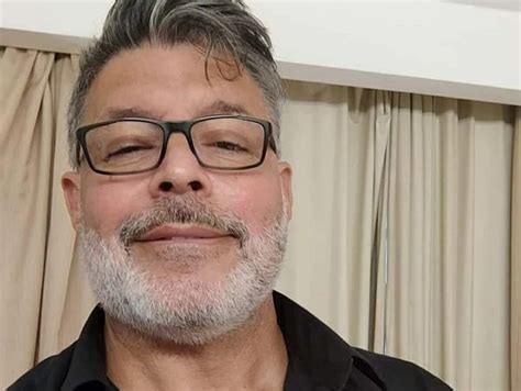 Alexandre Frota Exibe Rosto Ap S Harmoniza O Facial