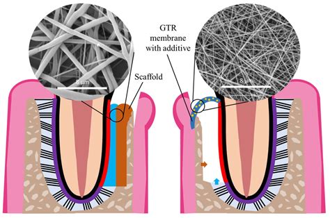 Recent Advances On Electrospun Nanofibers For Periodontal Regeneration Departamento De