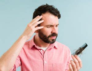 Tell Tale Signs Youre Going To Be Bald HairstyleCamp