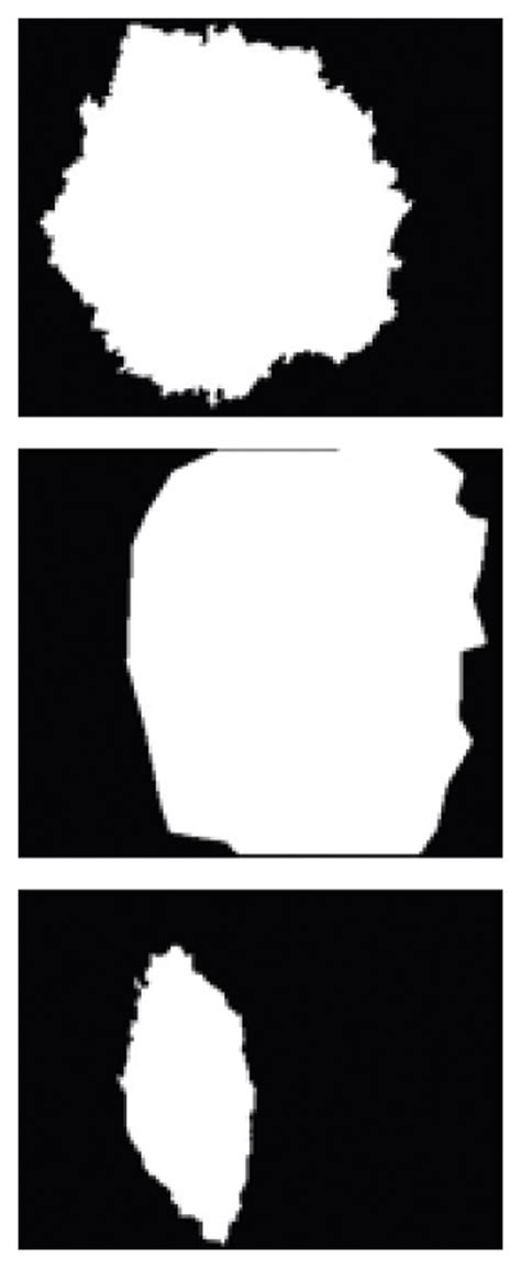 Sample Melanoma Segmentation Results Of Isic2016 Dataset From The Skin Download Scientific