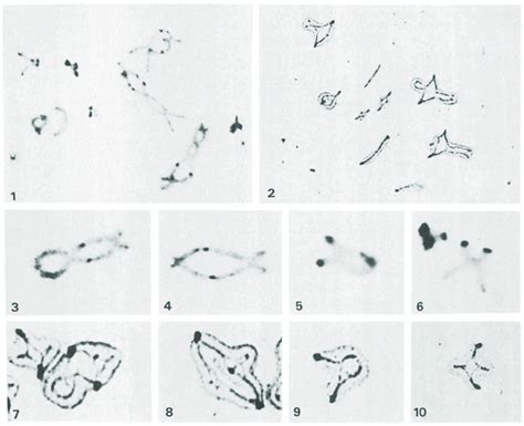 C Banded Diplotene Cell Figure 2 Metaphase I Cell In Which The Download Scientific Diagram
