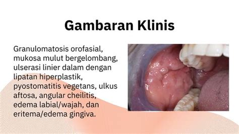 Chron Disease Pdf Laporan Kasus Tentang Pdf