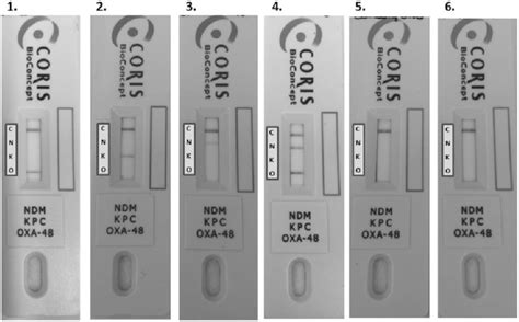 Multiplex Lateral Flow Immunochromatographic Assay For The Detection Of Download Scientific