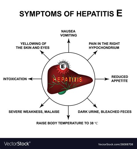 Symptoms Hepatitis E World Day Royalty Free Vector Image