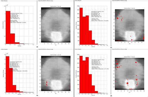 Γ Analysis Results Of An Example Imrt Pelvis Case Obtained Comparing