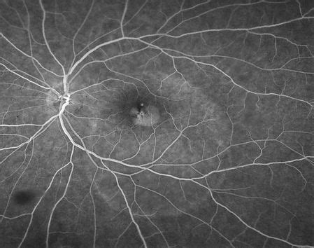 דר אסף דותן CSCR