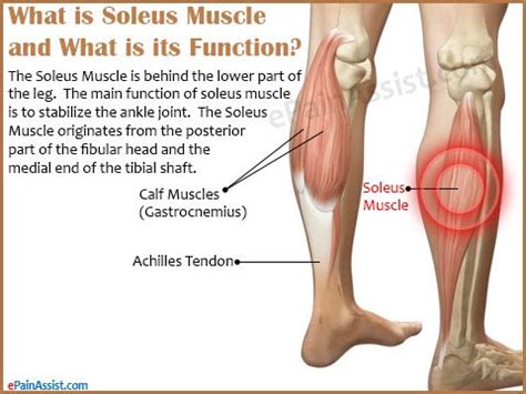 Soleus Muscle Straincausessymtomstreatment
