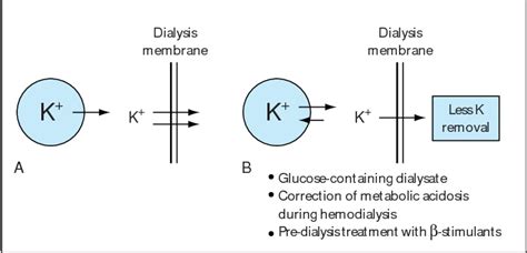 Figure 2 4 From 2 Dialysate Composition In Hemodialysis And Peritoneal