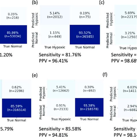 Schematic Illustrating Data Processing For A Eicu Patients And B Download Scientific