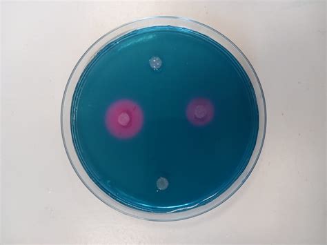 Antibiogramme De Substitution Svt Labs