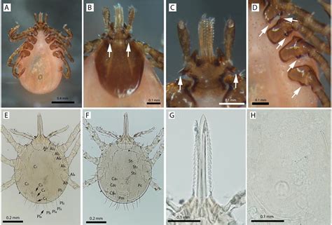 Micrographs Of The Ixodes Sp Nymph And The Larva Of Ornithodoros Sp