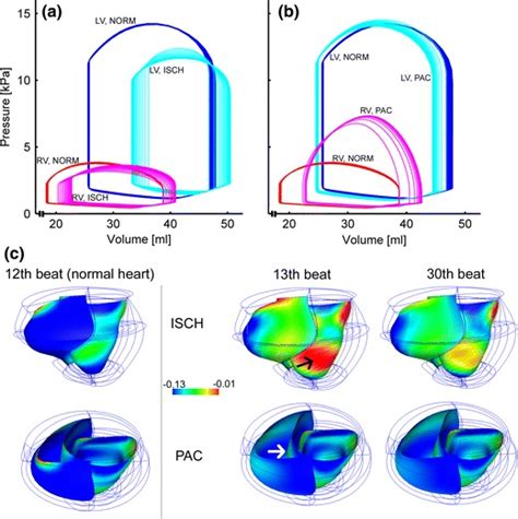 Lv And Rv Pv Loops For The A Isch And B Pac Simulation For