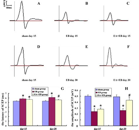 The Latency And Amplitude Of SCEP In Groups A B C D E And F Download Scientific Diagram