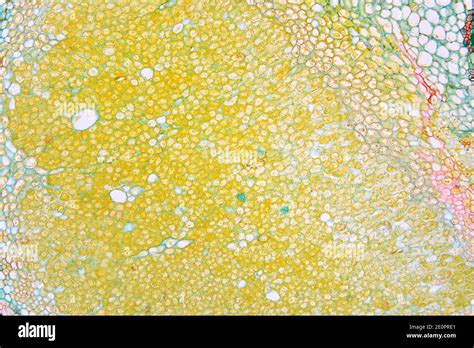 Root Nodule Bacteria Hi Res Stock Photography And Images Alamy