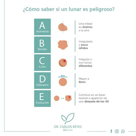Conoce El Abcde De Los Lunares Drcarlos Reyes Skinmon