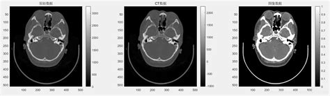 Matlab医学dicom影像读取与预处理matlab Dicom Csdn博客