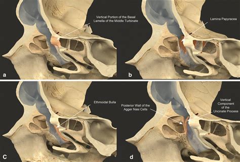 Walls Of The Frontal Recess A Medially The Vertical Portion Of The