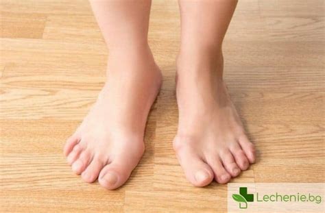 ᐉ Операция при кокалче на палеца на крака — Lechenie Bg