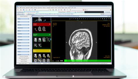 Funsoft® Integrated Healthcare Information Management System I Hmis System Partners Limited