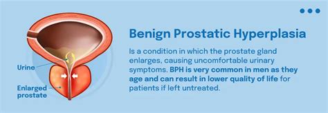 Benign Prostatic Hyperplasia Bph Londonsono