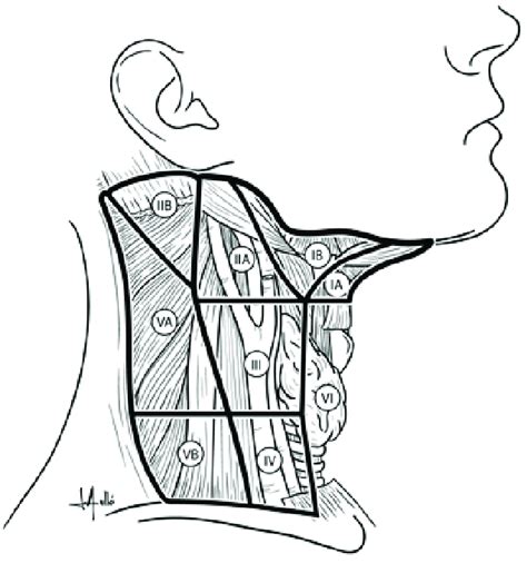 Leveling System Of Cervical Lymph Nodes Level I Contains The Submental Download Scientific