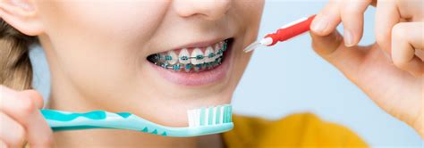 How To Brush Floss With Braces Foods To Avoid I Dental