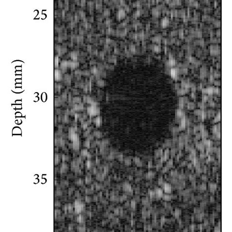 Clutter Reduction Using Mca On Iq Data Of Simulation Images When The
