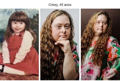 باور کنید افراد مبتلا به سندرم داون هم پیر میشوند